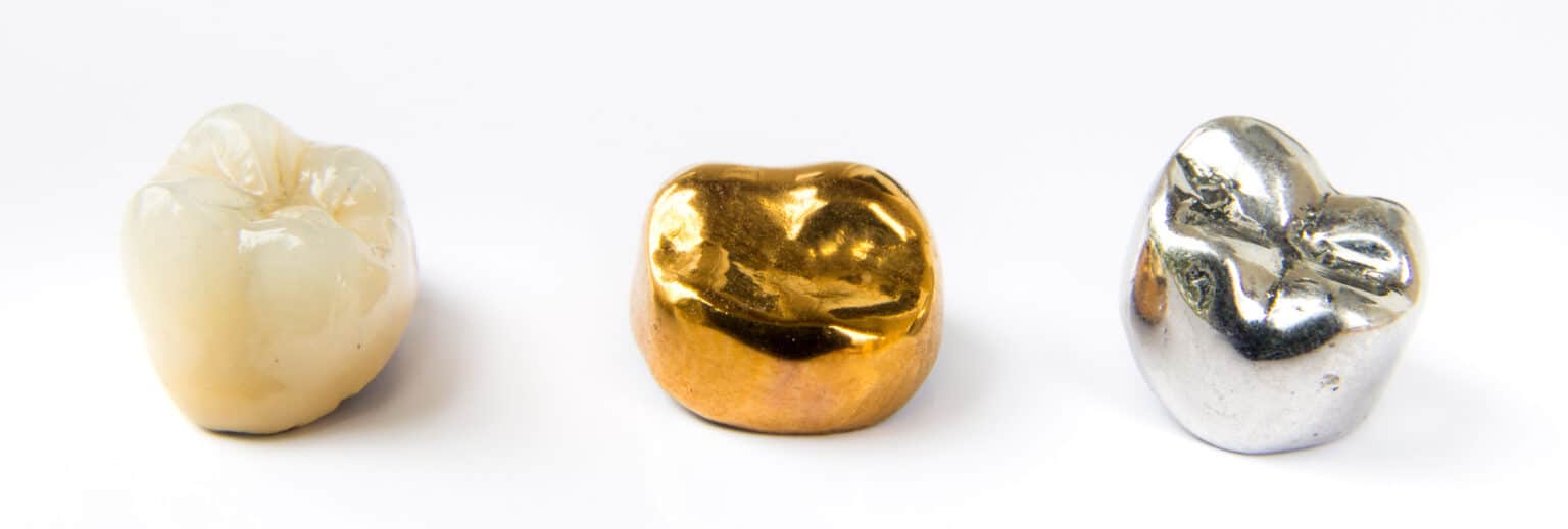 Understanding Dental Crown Material Options - BDG Las Vegas